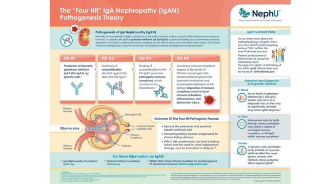IgA Nephropathy (KDIGO 2021 Guidelines) - Dr. Gawad | PPT