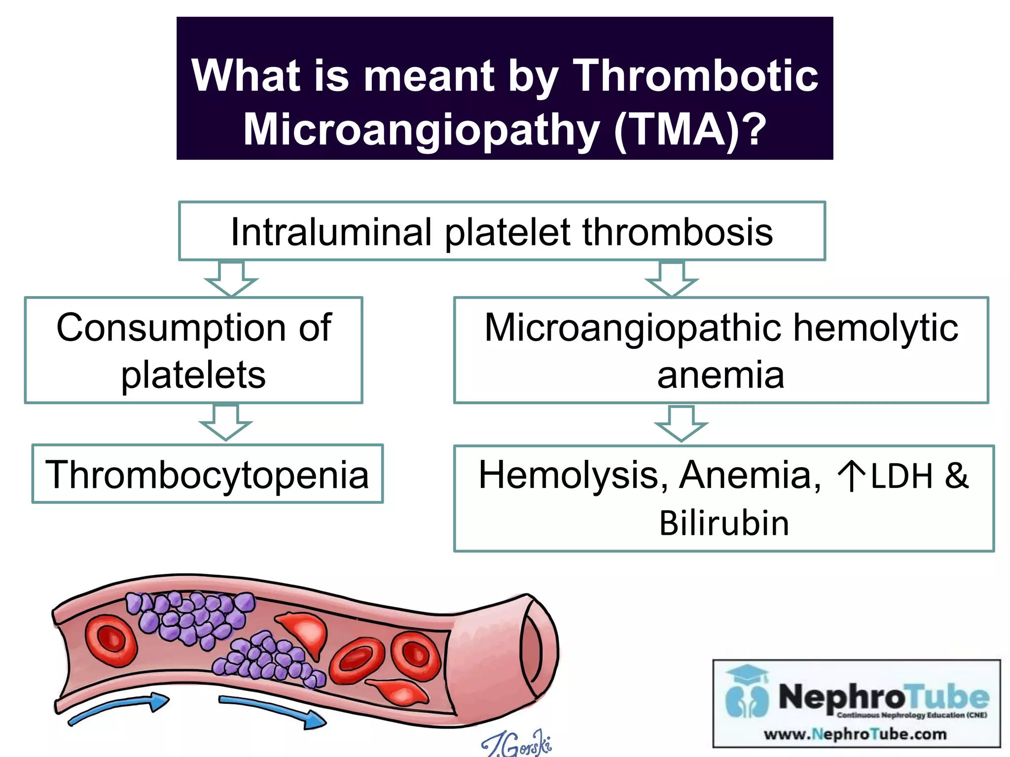 Thrombotic Microangiopathy (TMA) in Adults and Acute Kidney Injury - Dr. Gawad | PDF | Blood ...