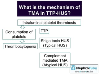 Thrombotic Microangiopathy (TMA) in Adults and Acute Kidney Injury - Dr ...