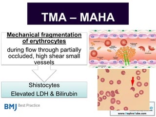 Thrombotic Microangiopathy (TMA) in Adults and Acute Kidney Injury - Dr ...