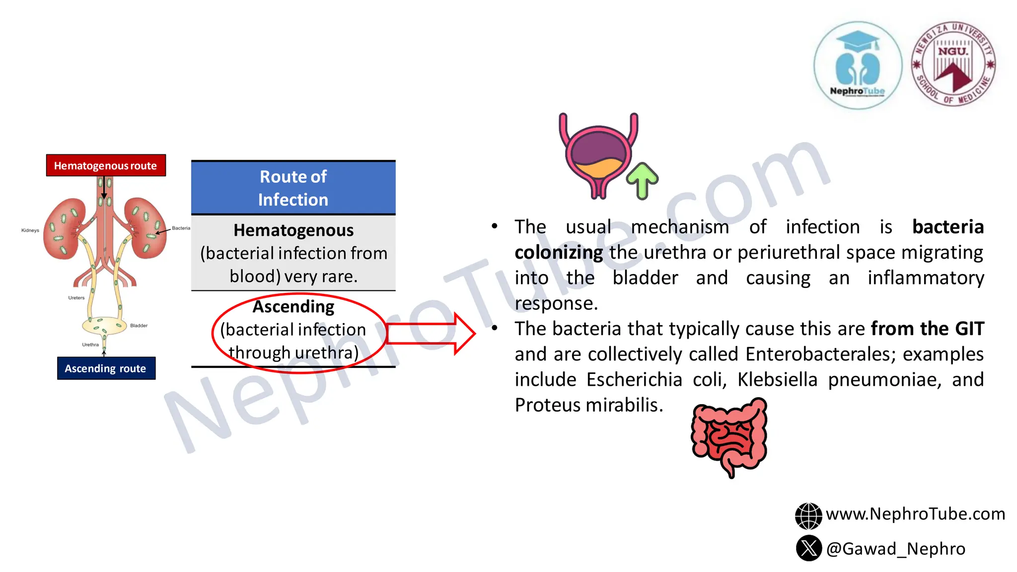 Urinary Tract Infection (Clinical Tips) - Dr. Gawad | PDF