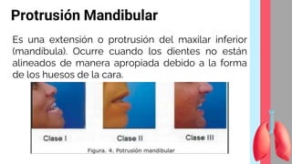 SLIDESHARE - VÍA AEREA DIFICIL.pdf
