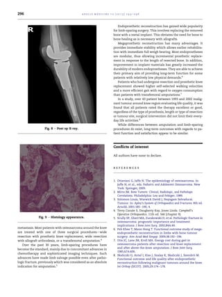 Megaprosthetic replacement of knee in a young boy of 14 years | PDF