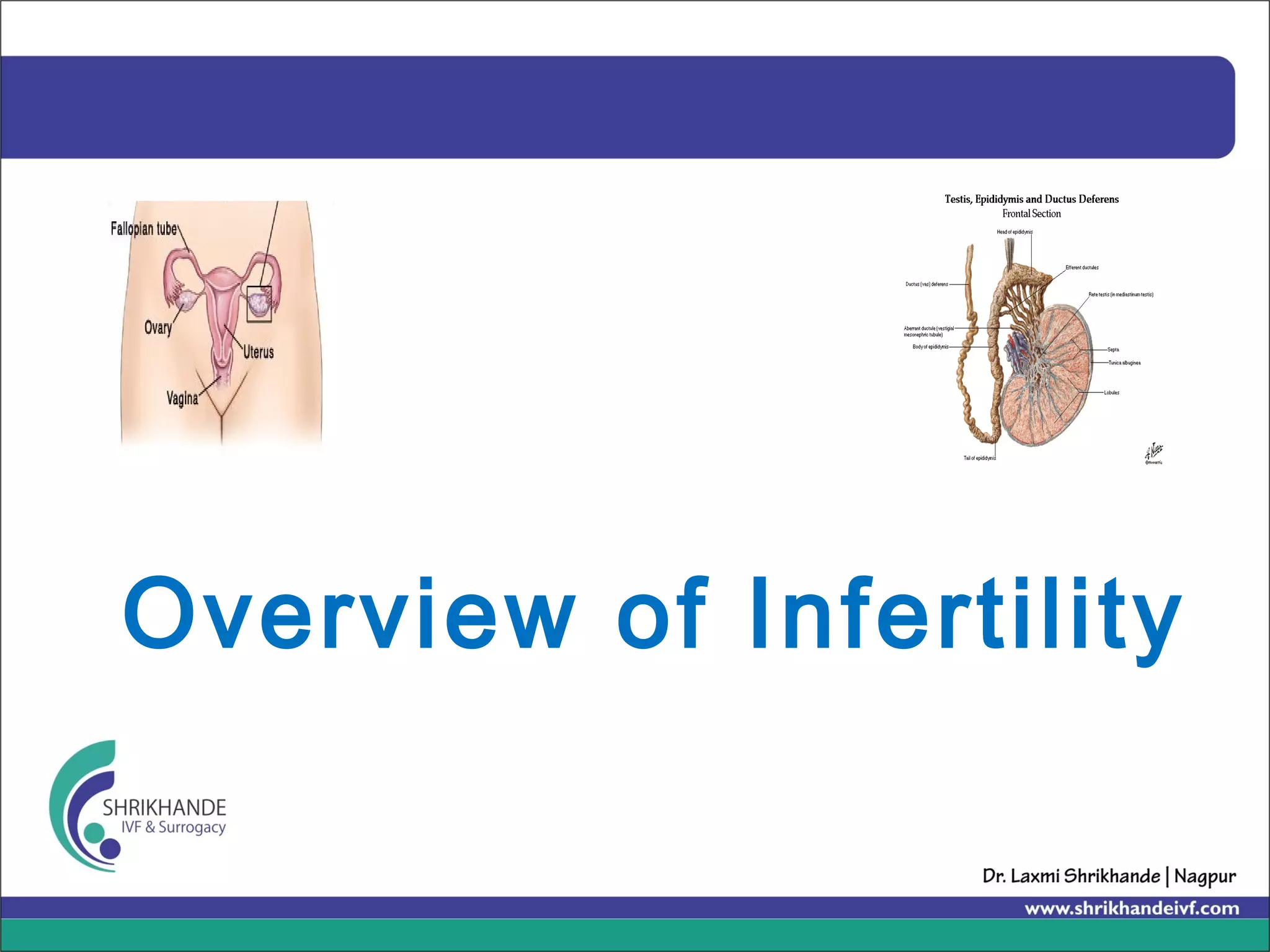 Complete Guide To Infertility | PPT