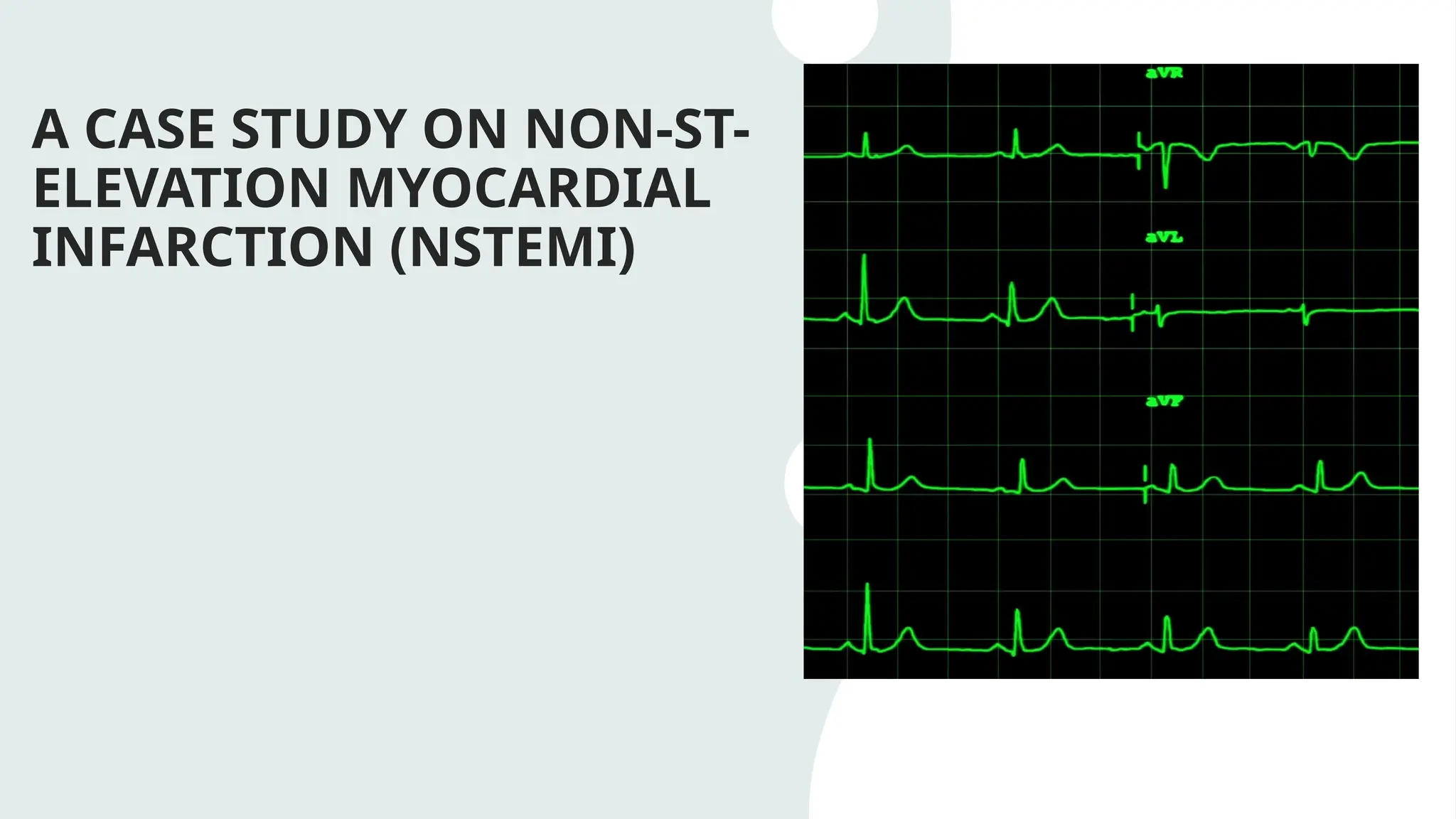 a case study on non ST elevation MI ( NSTEMI) | PPTX