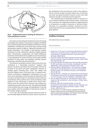 Percutaneous fixation of bilateral anterior column acetabular fractures ...