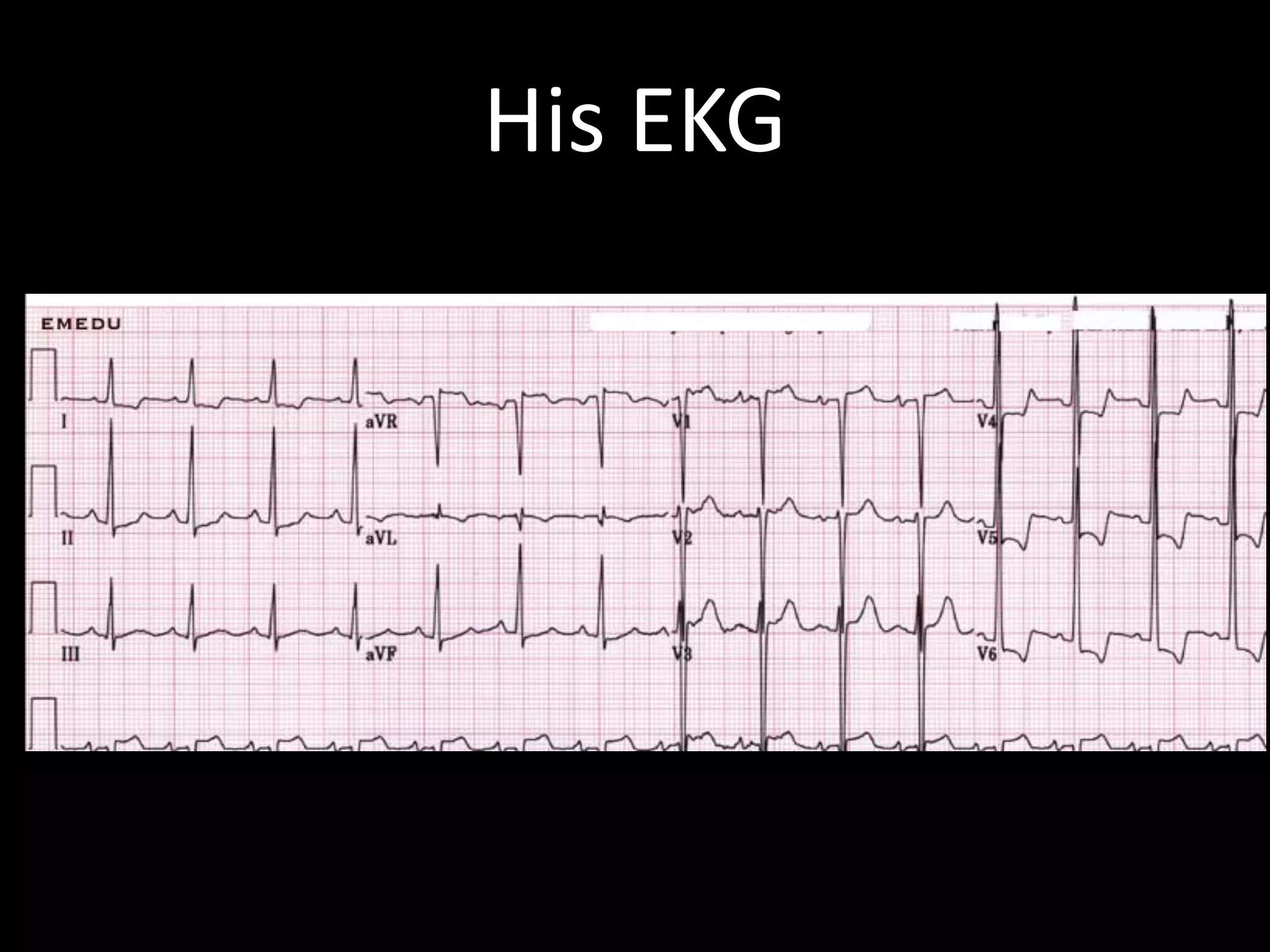 Slideshare acs core content | PPT | Free Download