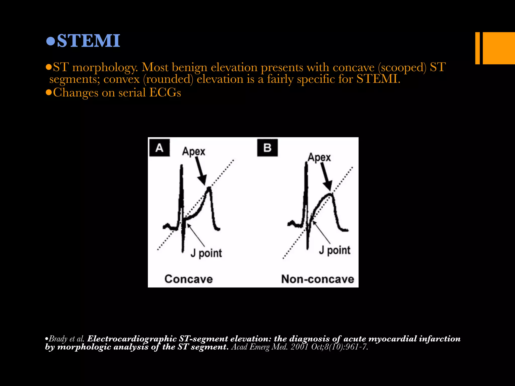 Slideshare acs core content | PPT