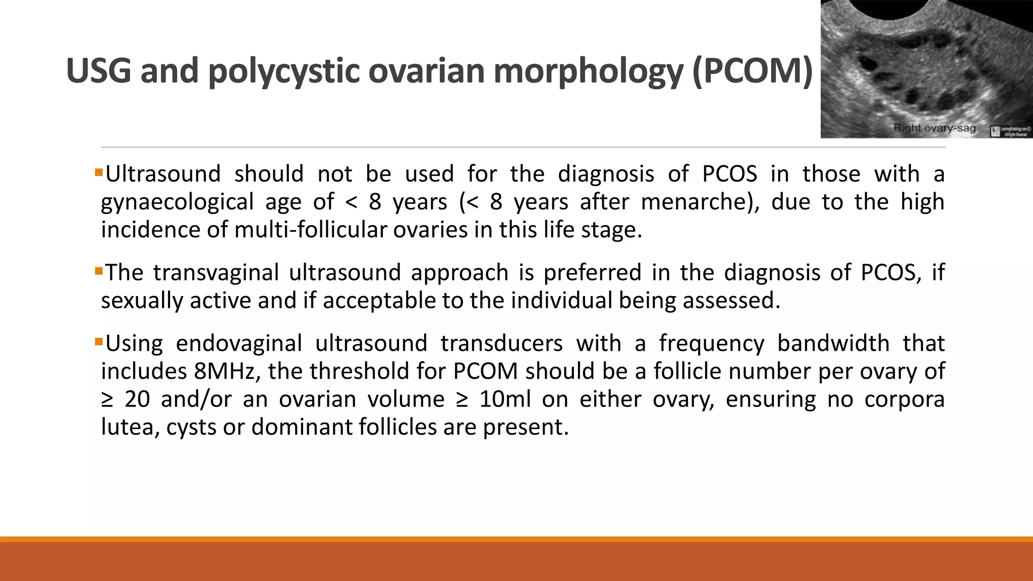 Presentation on Diagnosis of Polycystic Ovary Syndrome (PCOS) | PDF