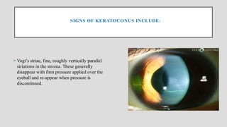 Keratoconus Explained: From Early Signs to Advanced Management | PPTX