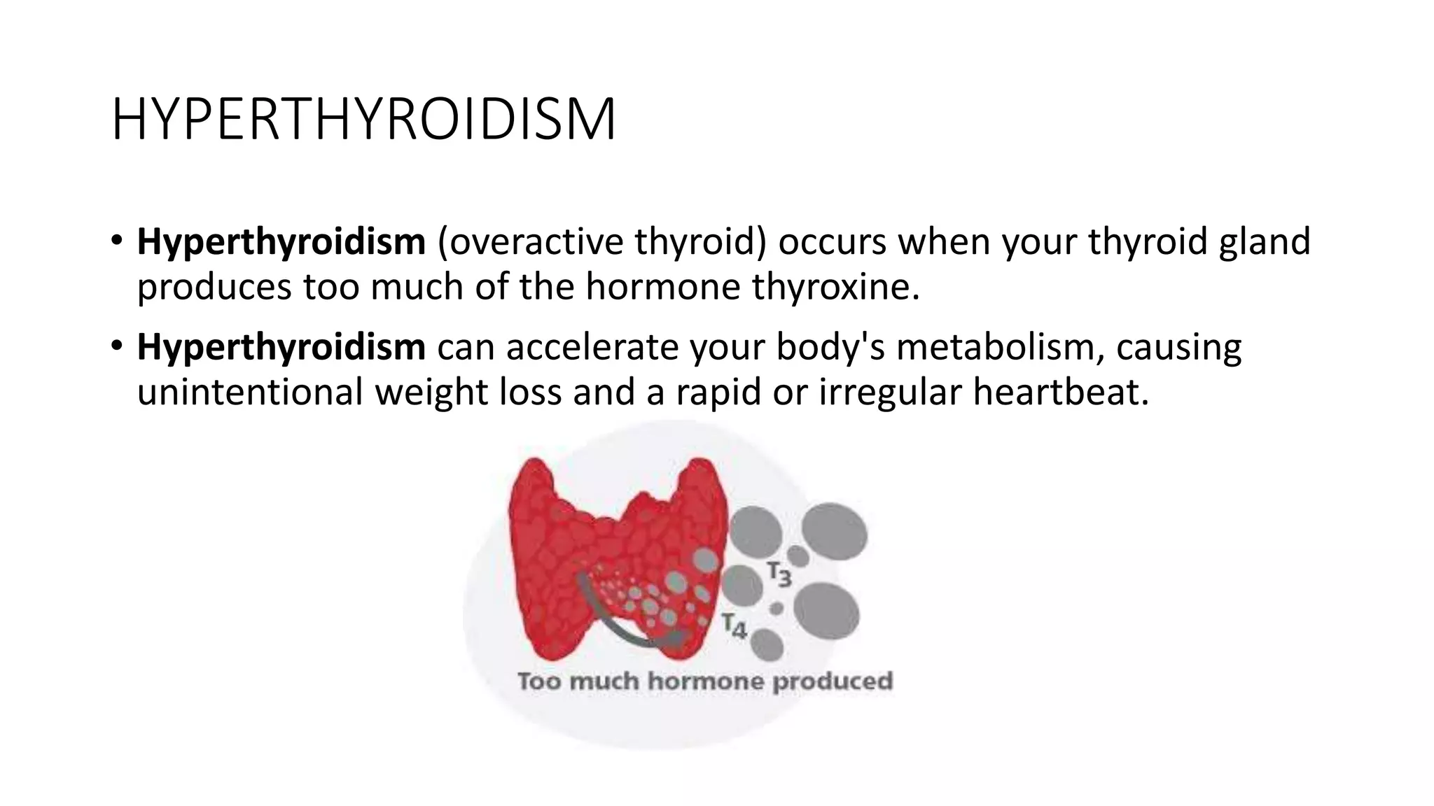 CASE PRESENTATION ON HYPERTHYROIDISM | PPTX
