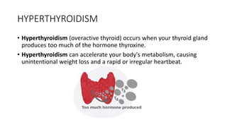CASE PRESENTATION ON HYPERTHYROIDISM | PPTX