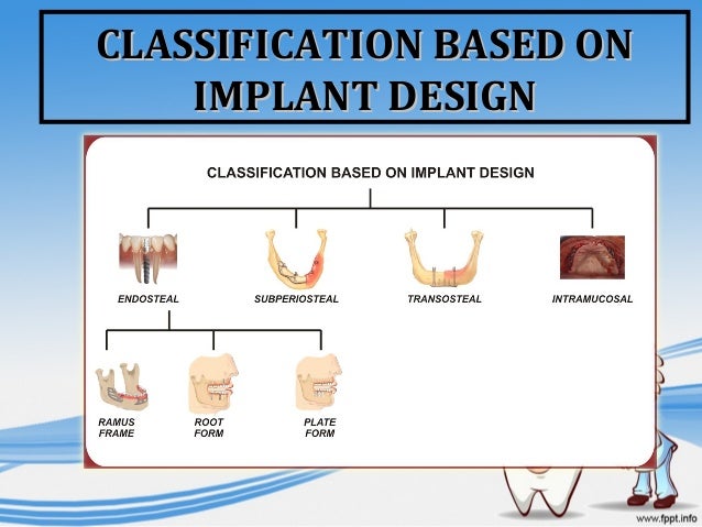Dental Implants