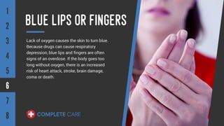 8 Signs and Symptoms of a Drug Overdose | PDF