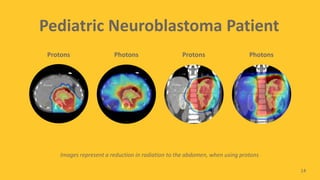 Proton Therapy: Who is a candidate? | PPTX