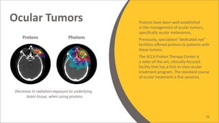 Proton Therapy: Who is a candidate? | PPTX