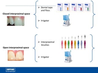 Importance of Interproximal Hygiene | PPTX