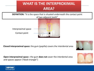 Importance of Interproximal Hygiene | PPTX