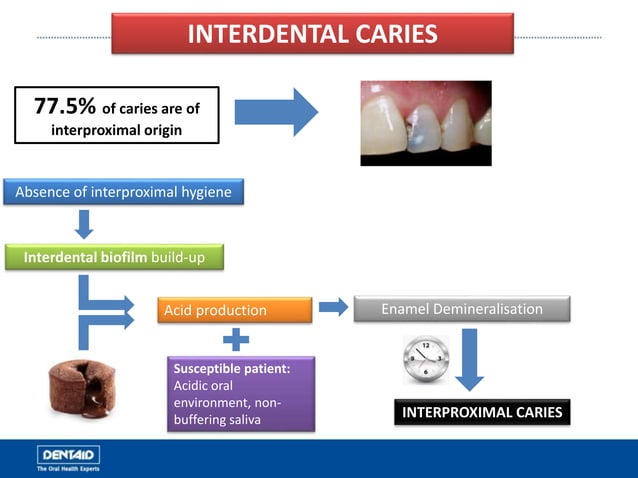 Importance of Interproximal Hygiene | PPTX | Oral care | Personal Care