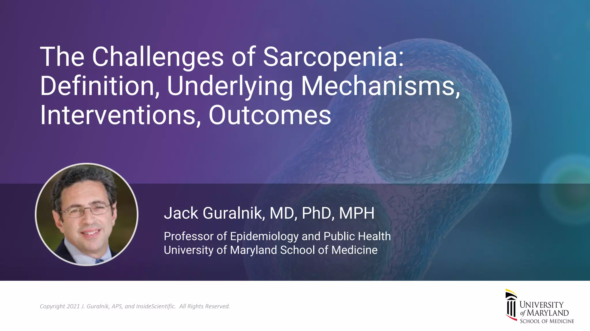 The Challenges of Sarcopenia: Definition, Underlying Mechanisms ...