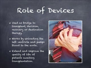 A Closer Look at LVAD | PDF