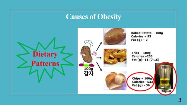 Nutritional Aspects of Obesity | PPT