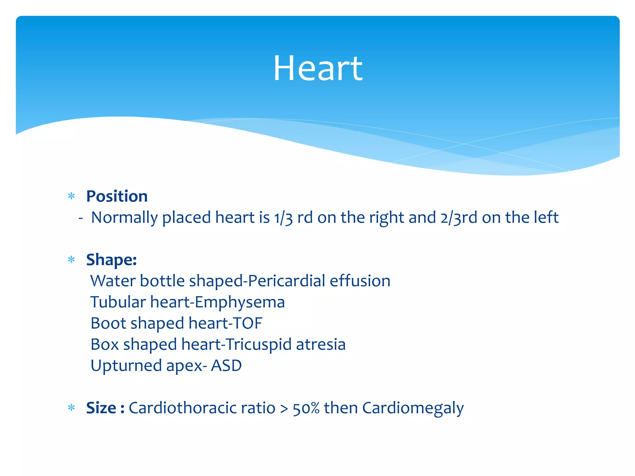 Viewing chest x ray | PPTX