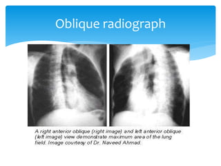 Viewing chest x ray | PPTX | Death, Injury, or Military Conflict ...