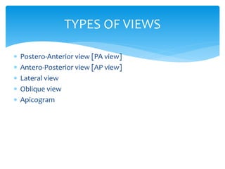 Viewing chest x ray | PPTX | Death, Injury, or Military Conflict ...