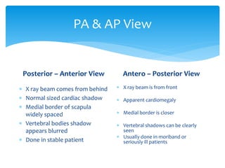 Viewing chest x ray | PPTX | Death, Injury, or Military Conflict ...