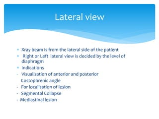 Viewing chest x ray | PPTX | Death, Injury, or Military Conflict ...