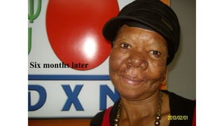 Slideshare presentation Maria- face- before and after | PPTX