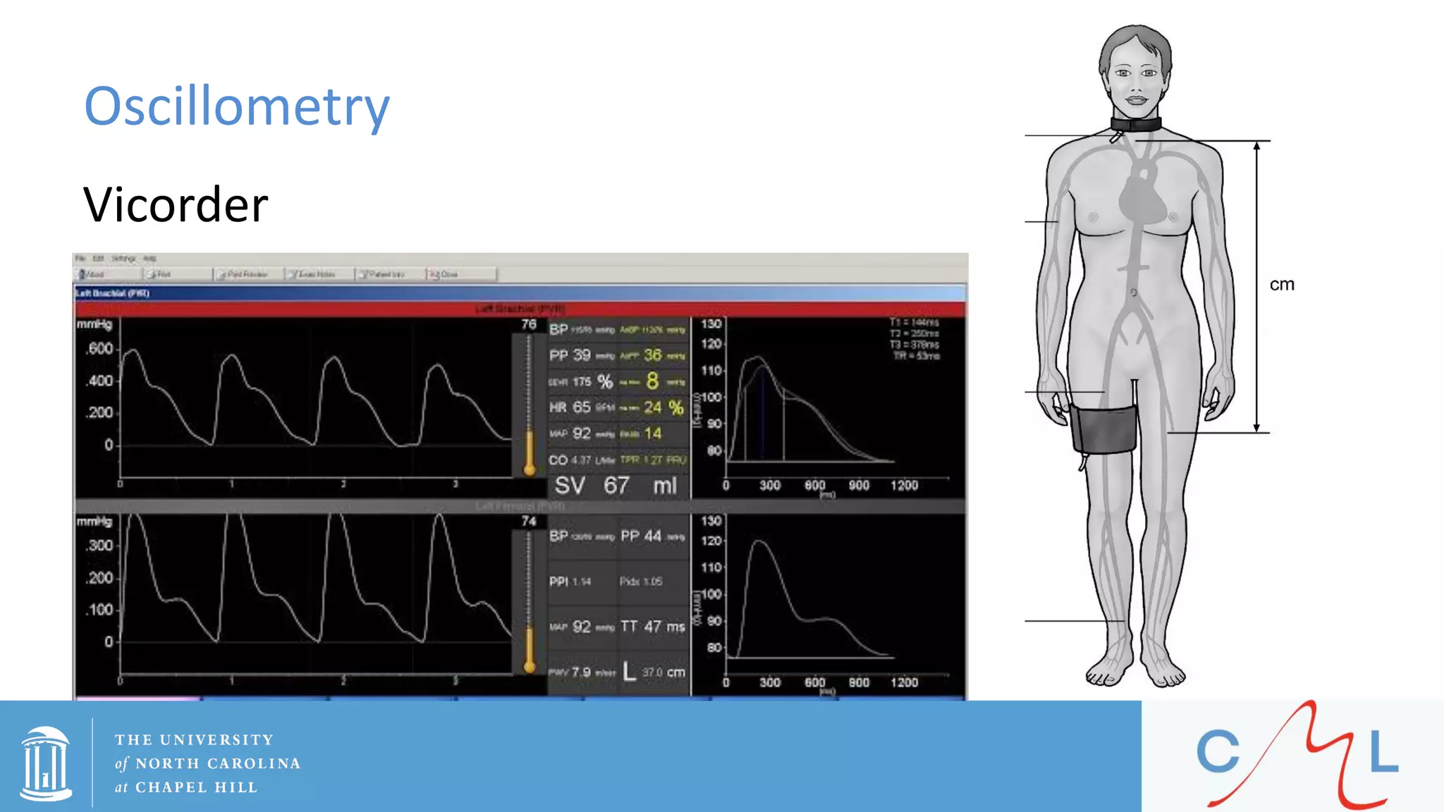 Pulse Wave Velocity: Theory, Applications, Methods, and Future ...