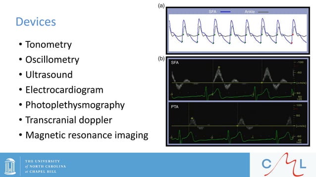 Pulse Wave Velocity: Theory, Applications, Methods, and Future Directions | PDF
