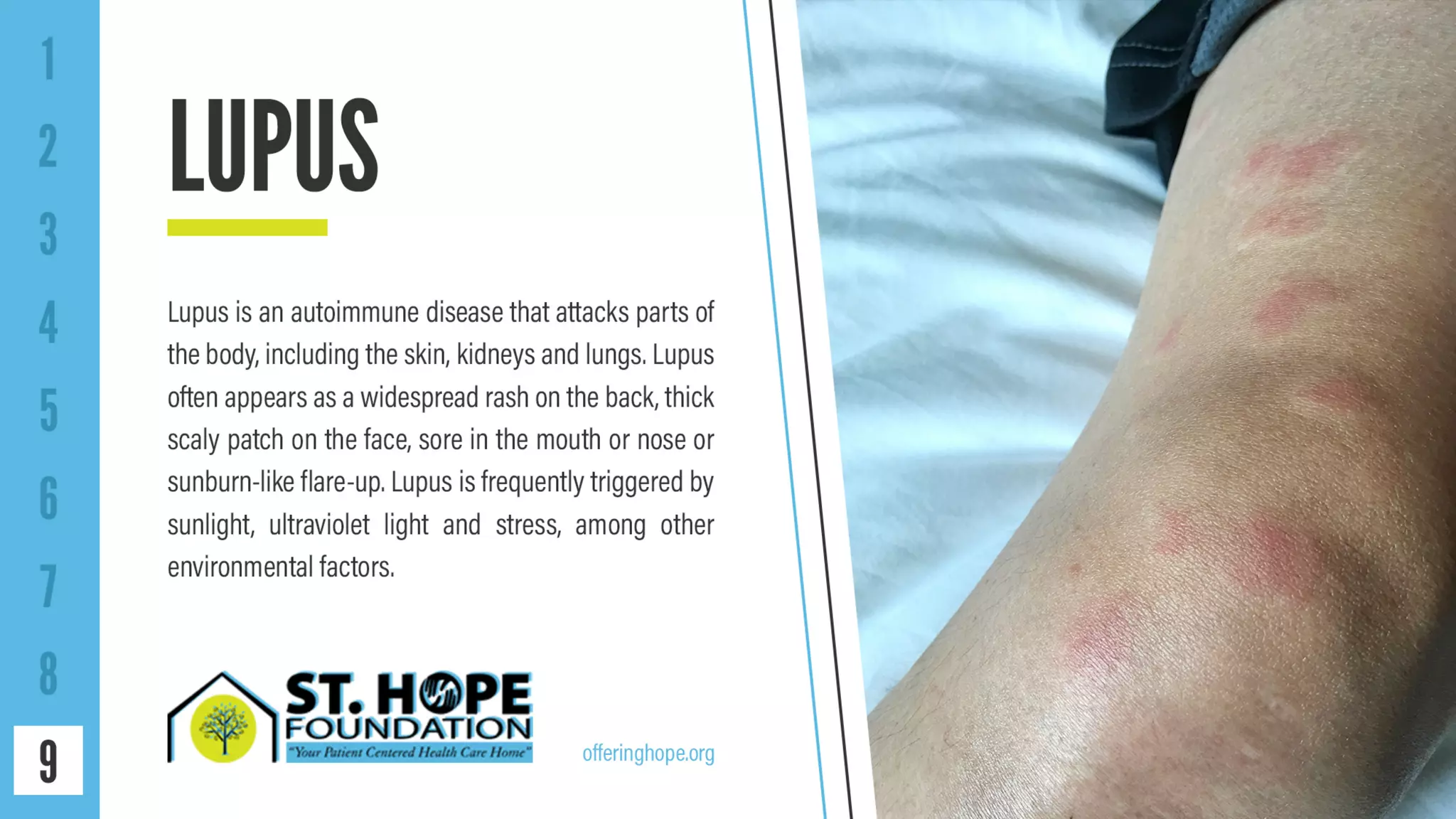 9 Common Skin Disorders | PDF