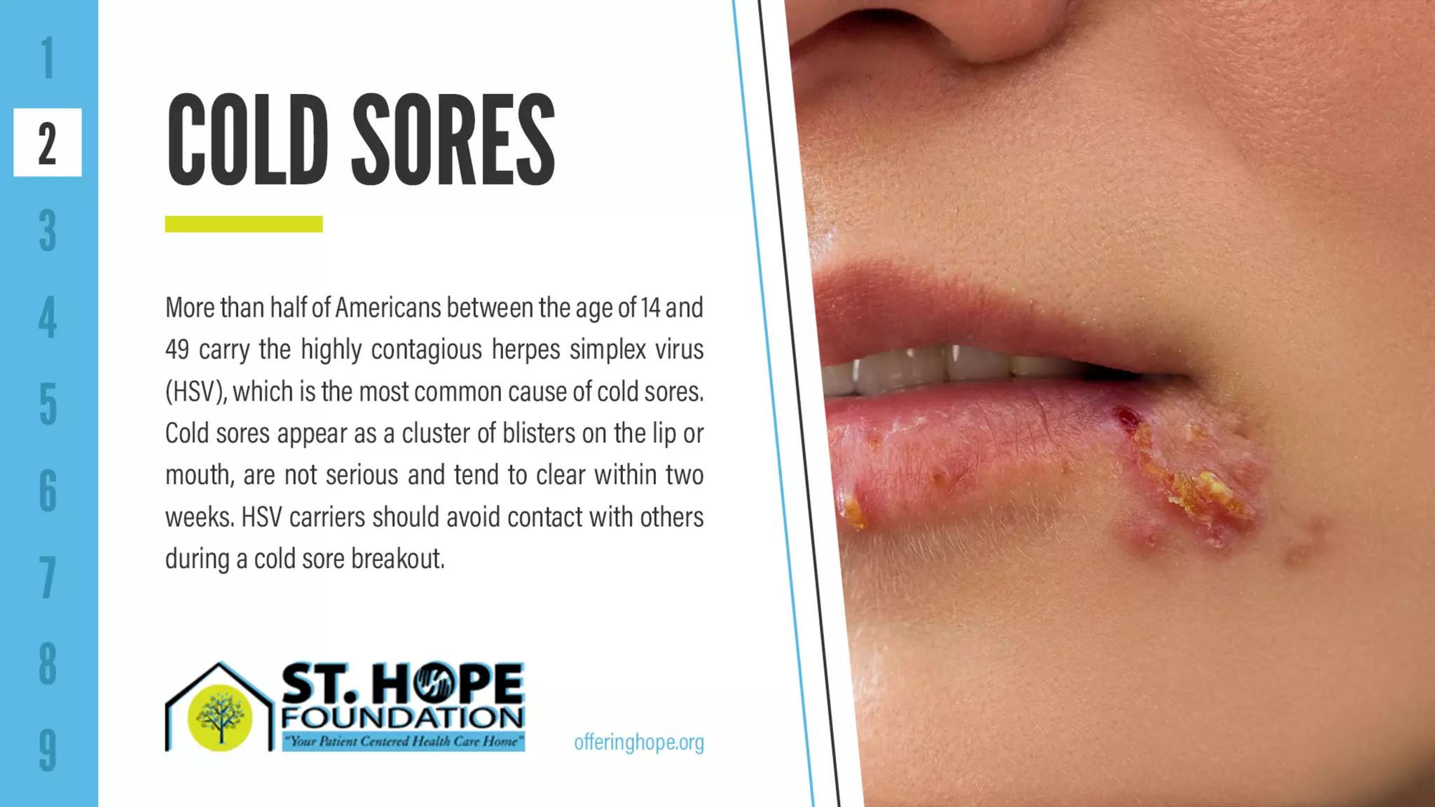 9 Common Skin Disorders | PDF