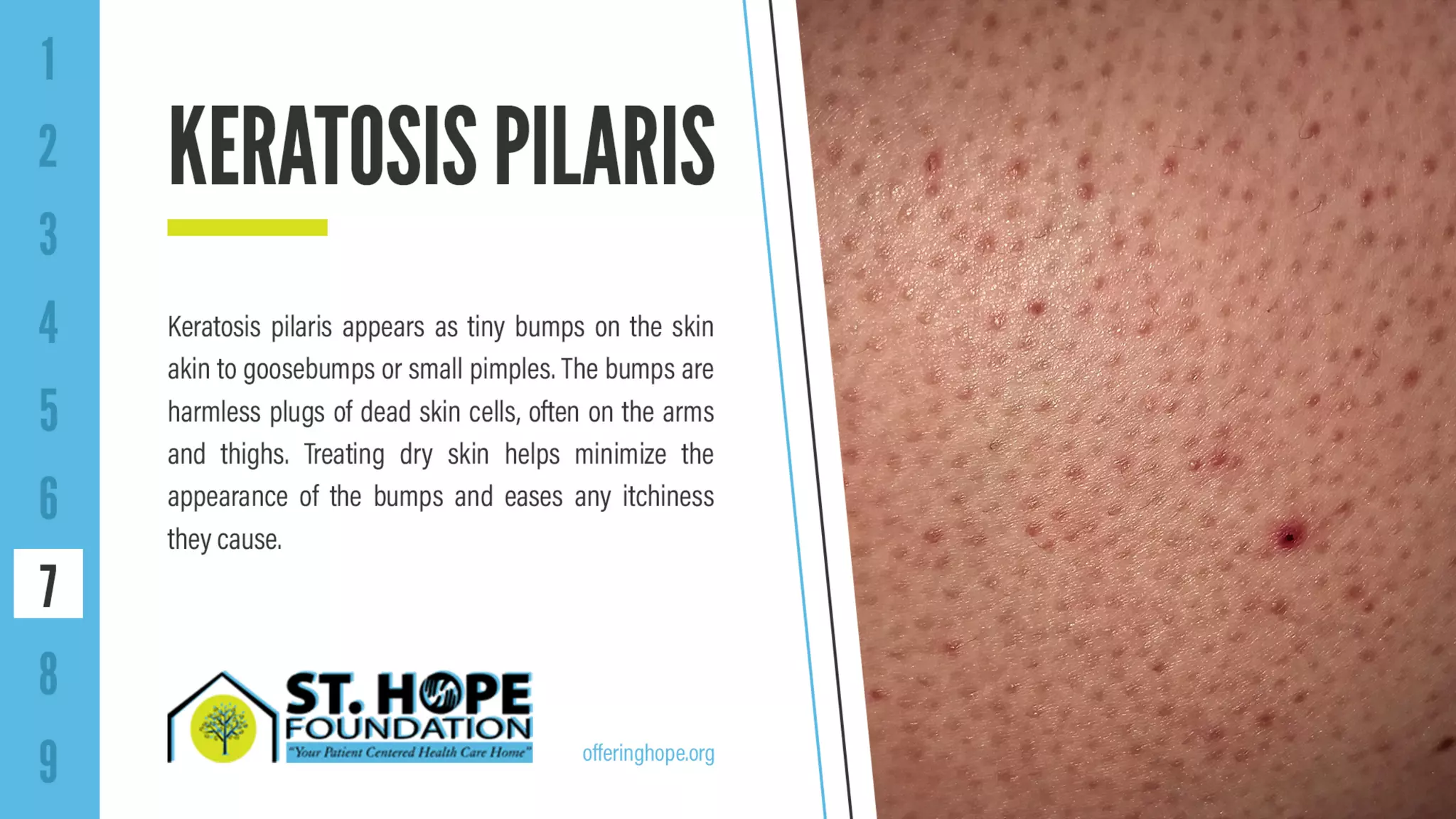 9 Common Skin Disorders | PDF