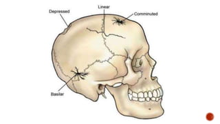 Compound Skull Fracture