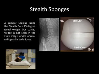Techno-Aide Positioning Sponges | PPTX