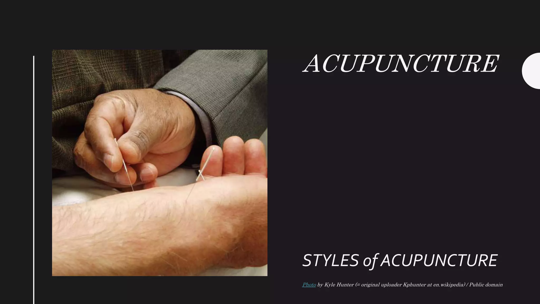 Slide share styles of acupuncture | PPT