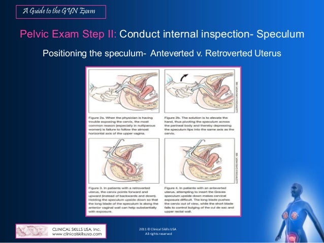 A Guide to the Clinical Gynecological Exam as Instructed by a Female