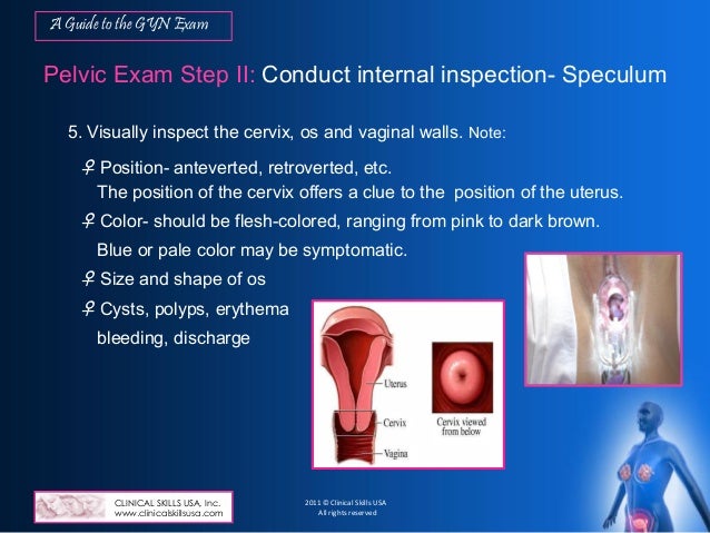 A Guide to the Clinical Gynecological Exam as Instructed by a Female