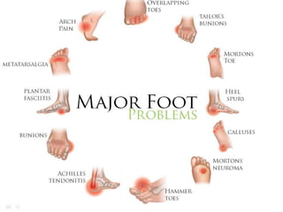 12 Major Foot Problems And Solutions | PPSX