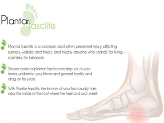 12 Major Foot Problems And Solutions | PPSX
