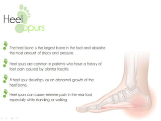 12 Major Foot Problems And Solutions | PPSX
