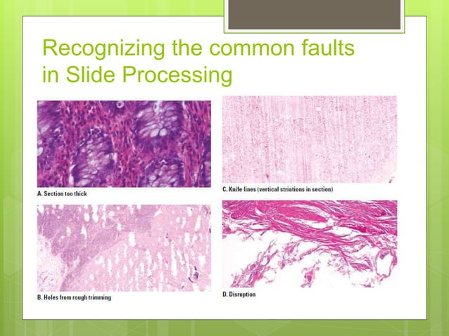 Tissue Processing for Histopathological Analysis