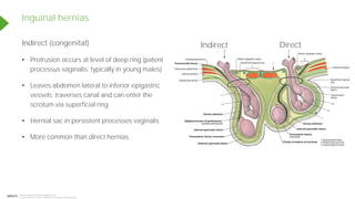 Slides_Inguinal_Region.pdf