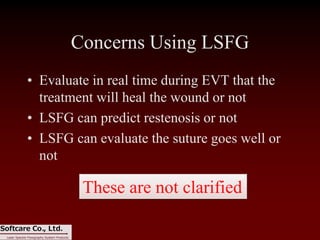 Introduction of Laser Speckle Flowgraphy LSFG-PFI | PDF