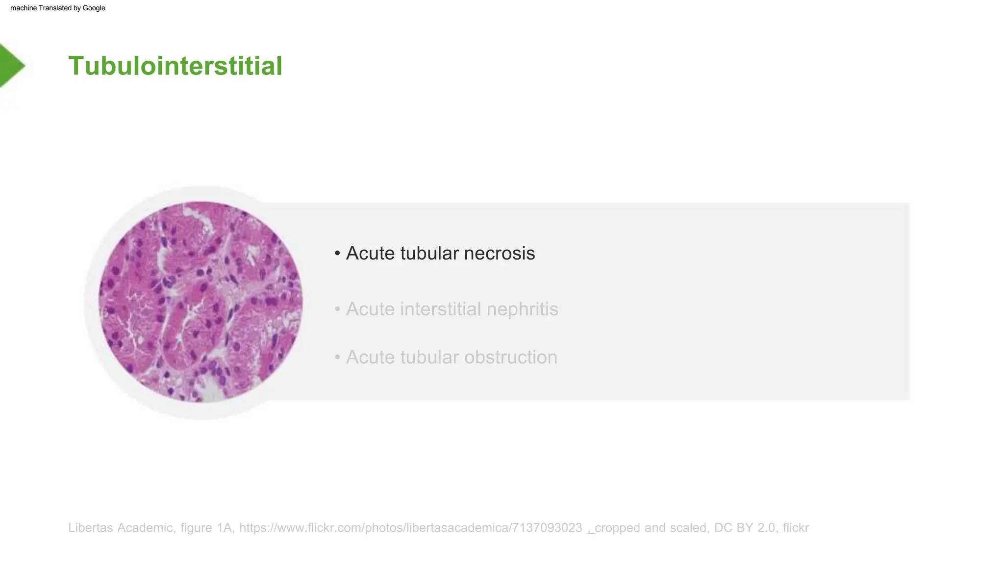 Slides_Nephrology_Acute_Kidney_Injury (1) (1).pptx
