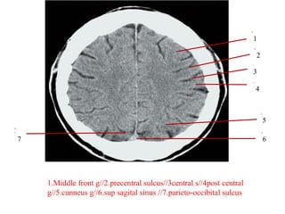 Slides of brain anatomy 1 | PPT